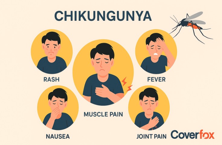 Chikungunya: Symptoms, Causes, Diagnosis, and Prevention Guide